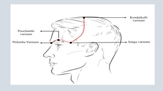 VARMAM Standard of procedure for the varmam related to head | PPTX