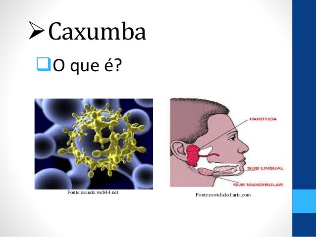 Varíola, rubéola, sarampo e caxumba