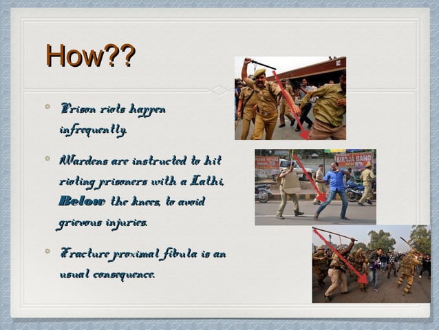 Varus scenarios in indian knee | PPT