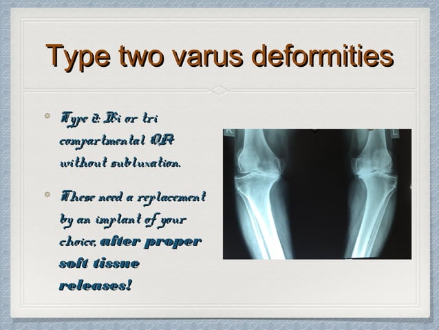 Varus scenarios in indian knee | PPT