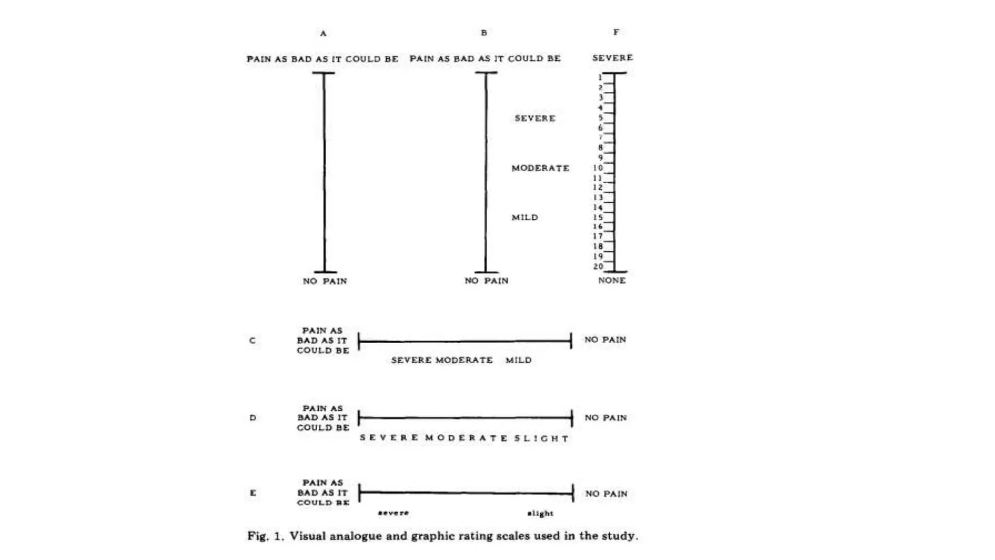 Visual Analog Scale (VAS) | PPTX