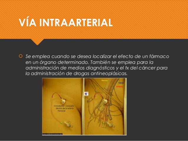 Vías de administración de los medicamentos