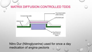 Transdermal drug delivery system | PPTX | Skin Care | Beauty