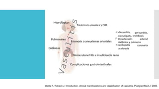 vasculitis seguro social Venezuela vascul | PPTX