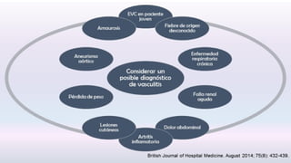 vasculitis seguro social Venezuela vascul | PPTX
