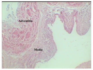 Vascular | PPT
