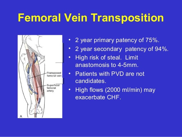 Vascular access