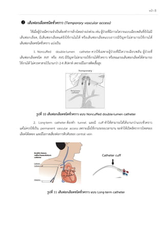 การดูแลเส้นฟอกเลือด (Vascular access) ในผู้ป่วยไตวายระยะสุดท้าย | PDF