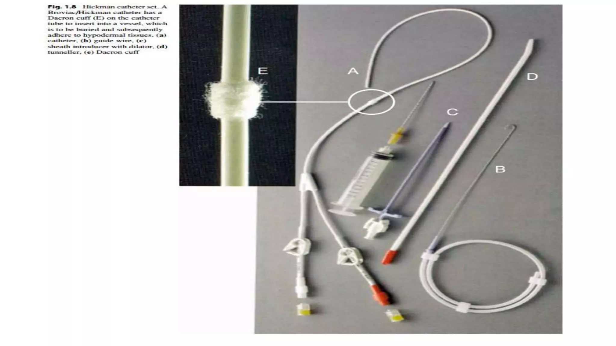 Vascular access in pediatrics | PPTX