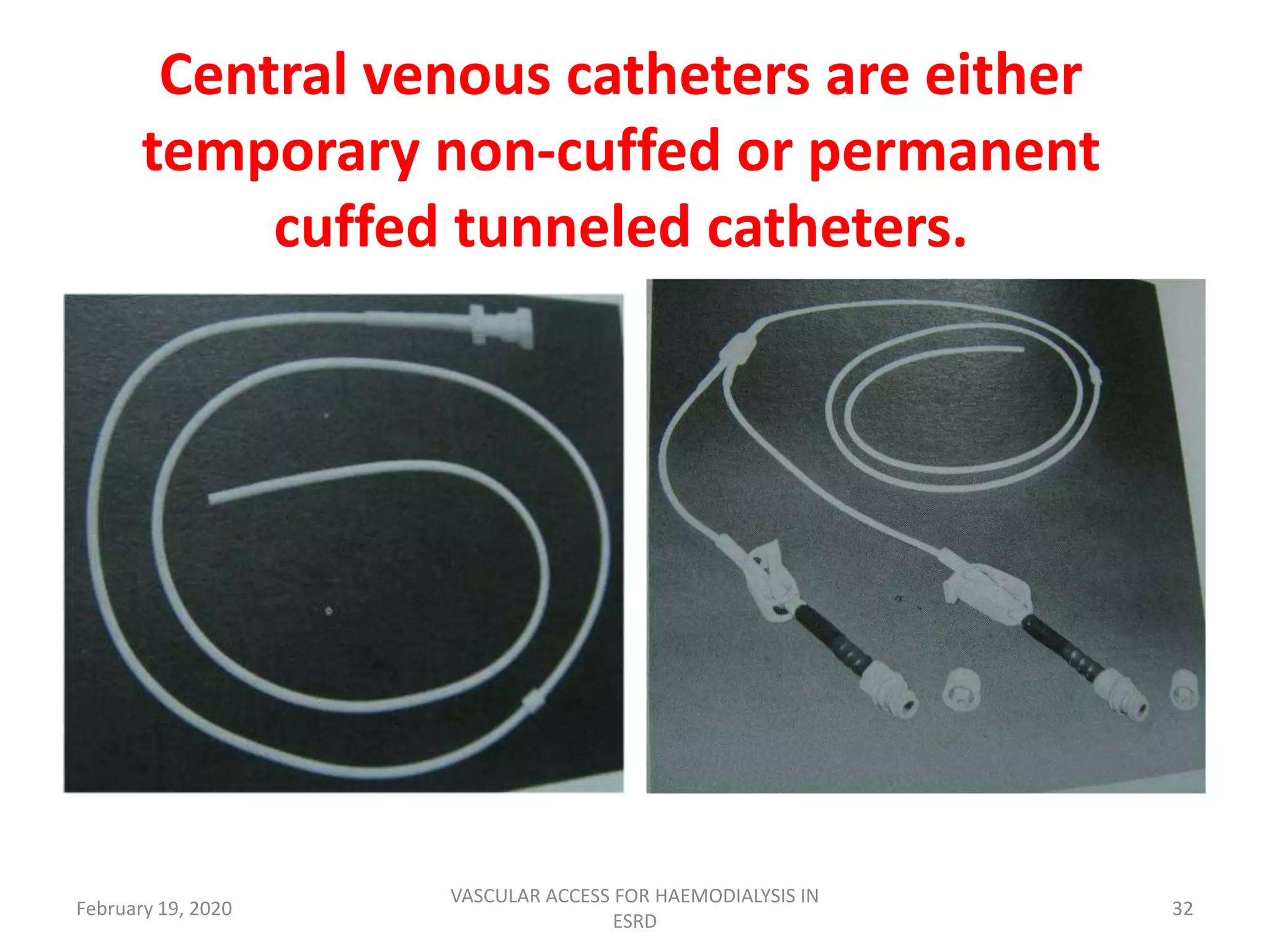 Vascular access | PPTX