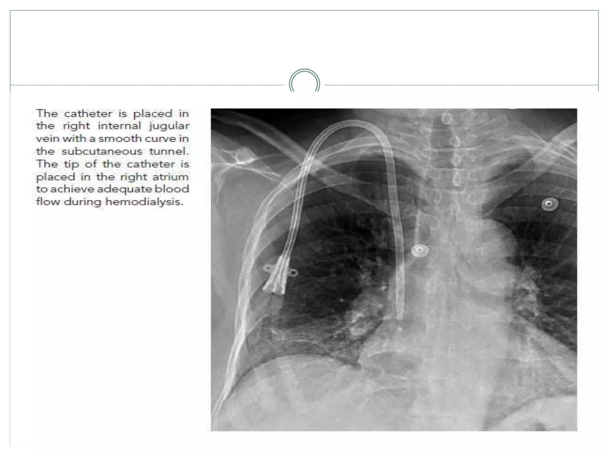 Vascular Access.pptx