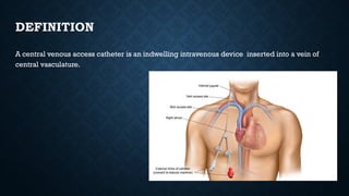 Vascular access - venous catheters (central and peripheral).pptx