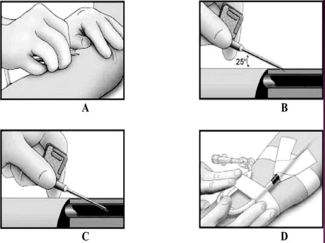 Vascular access 2019 | PPTX