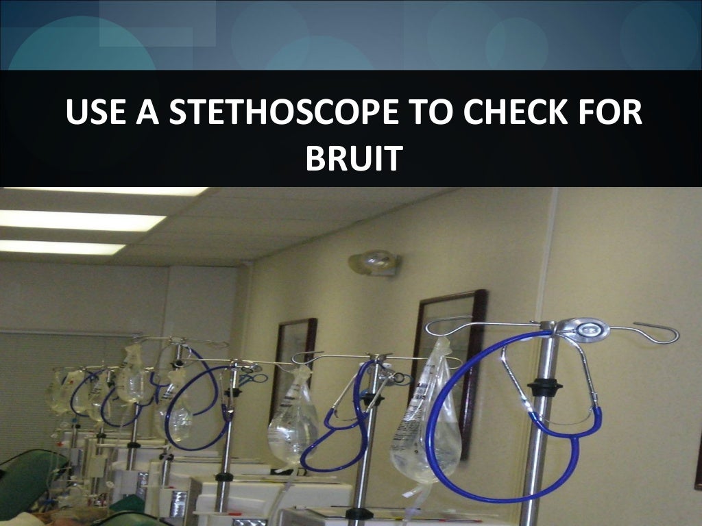 3 Types Of Vascular Access Ports Used In Hemodialysis