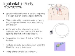 Vascular access devices | PPTX