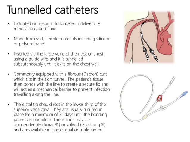 Vascular access devices | PPTX | First Aid | Injuries