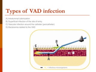 Vascular Access_English_smallpics (1).ppt