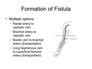Vascular access for haemodialysis prof. ahmed halawa | PPT