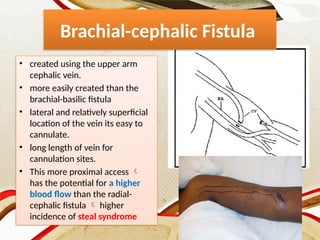 Vascular Access for Hemodialysis MTT Refarat.pptx