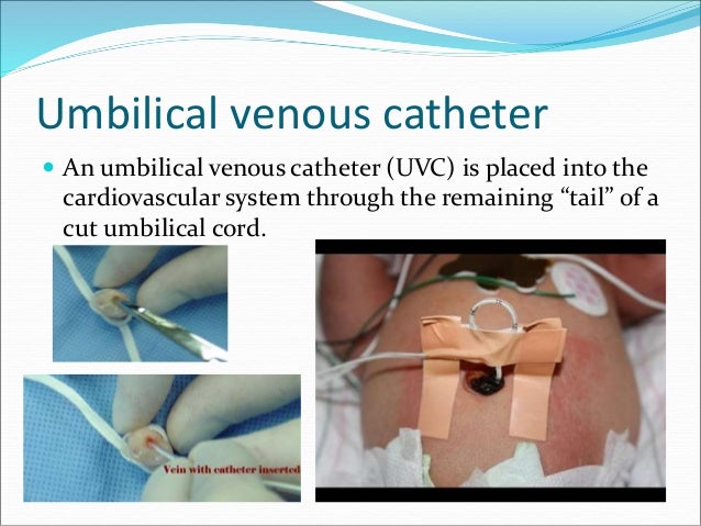 Vascular access in neonates small children dr. rasha helmy