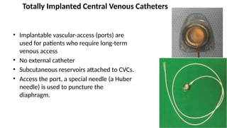 Vascular access in pediatric population. | PPTX