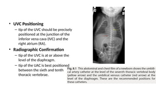 Vascular access in pediatric population. | PPT
