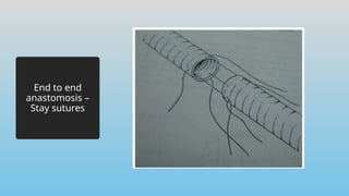 Principles of Vascular Anastomosis .pptx