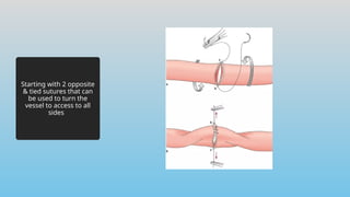 Principles of Vascular Anastomosis .pptx