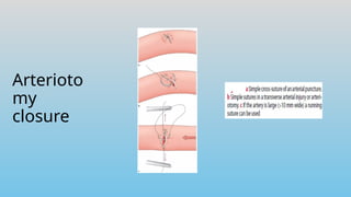 Principles of Vascular Anastomosis .pptx