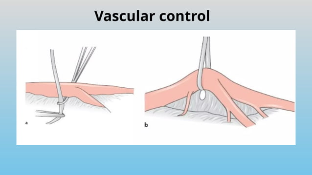 Principles of Vascular Anastomosis .pptx