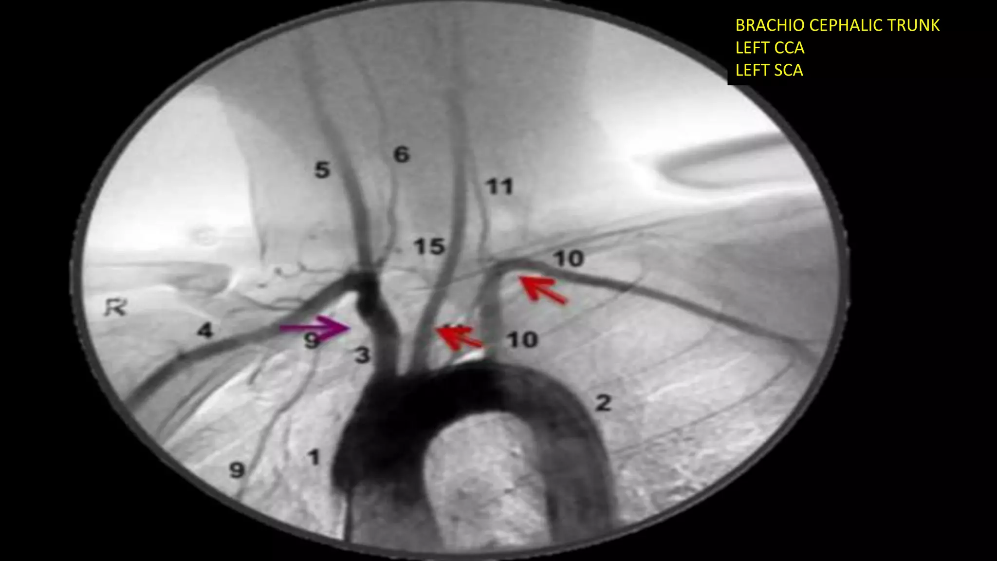 Vascular anatomy of brain | PPTX