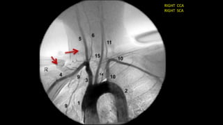 Vascular anatomy of brain | PPTX
