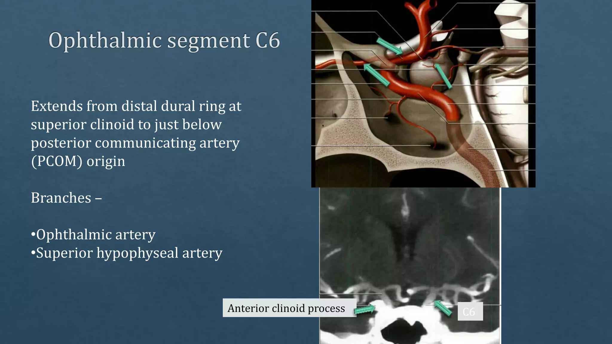 Radiological vascular anatomy of brain | PPTX