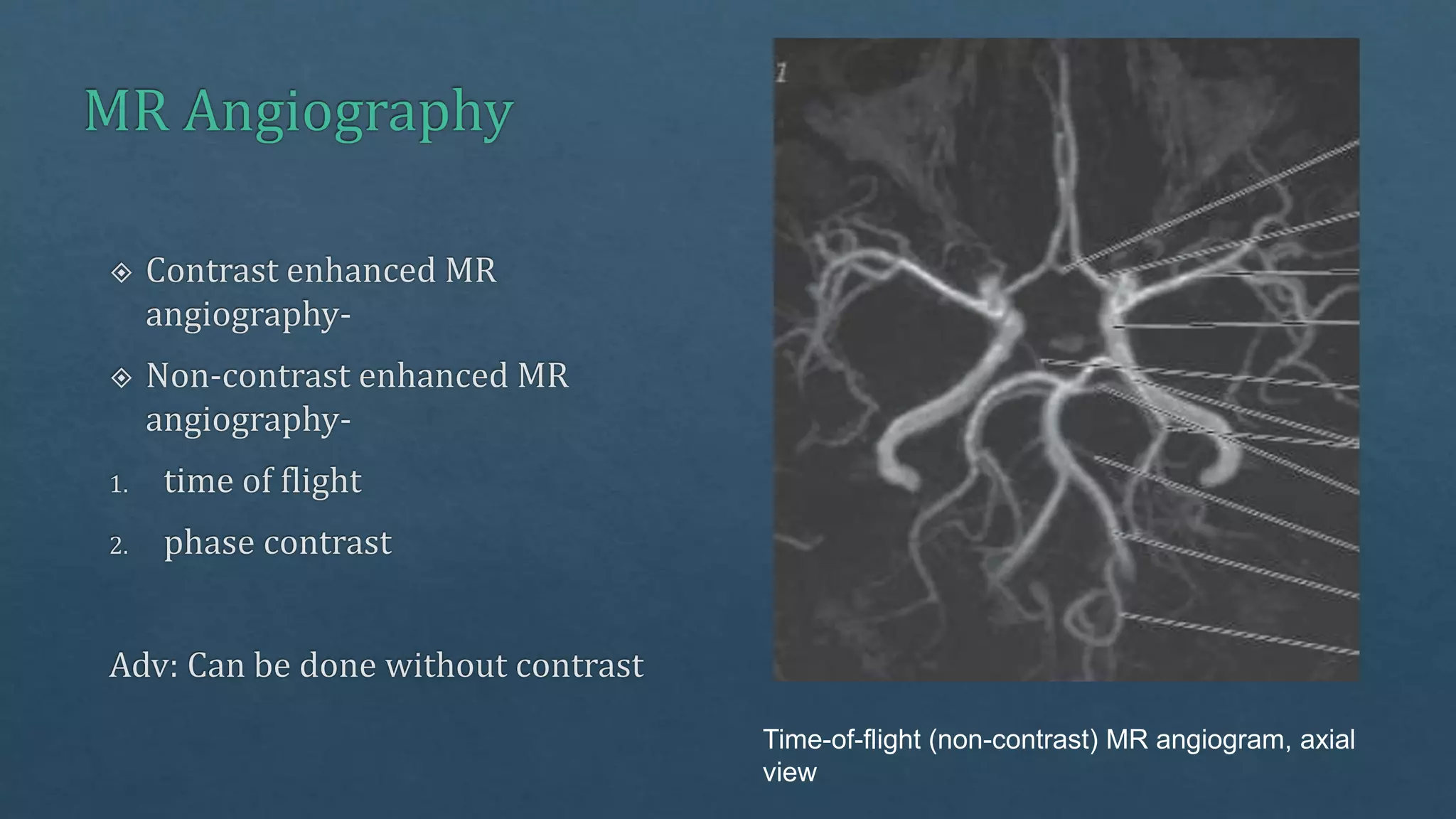 Radiological vascular anatomy of brain | PPTX