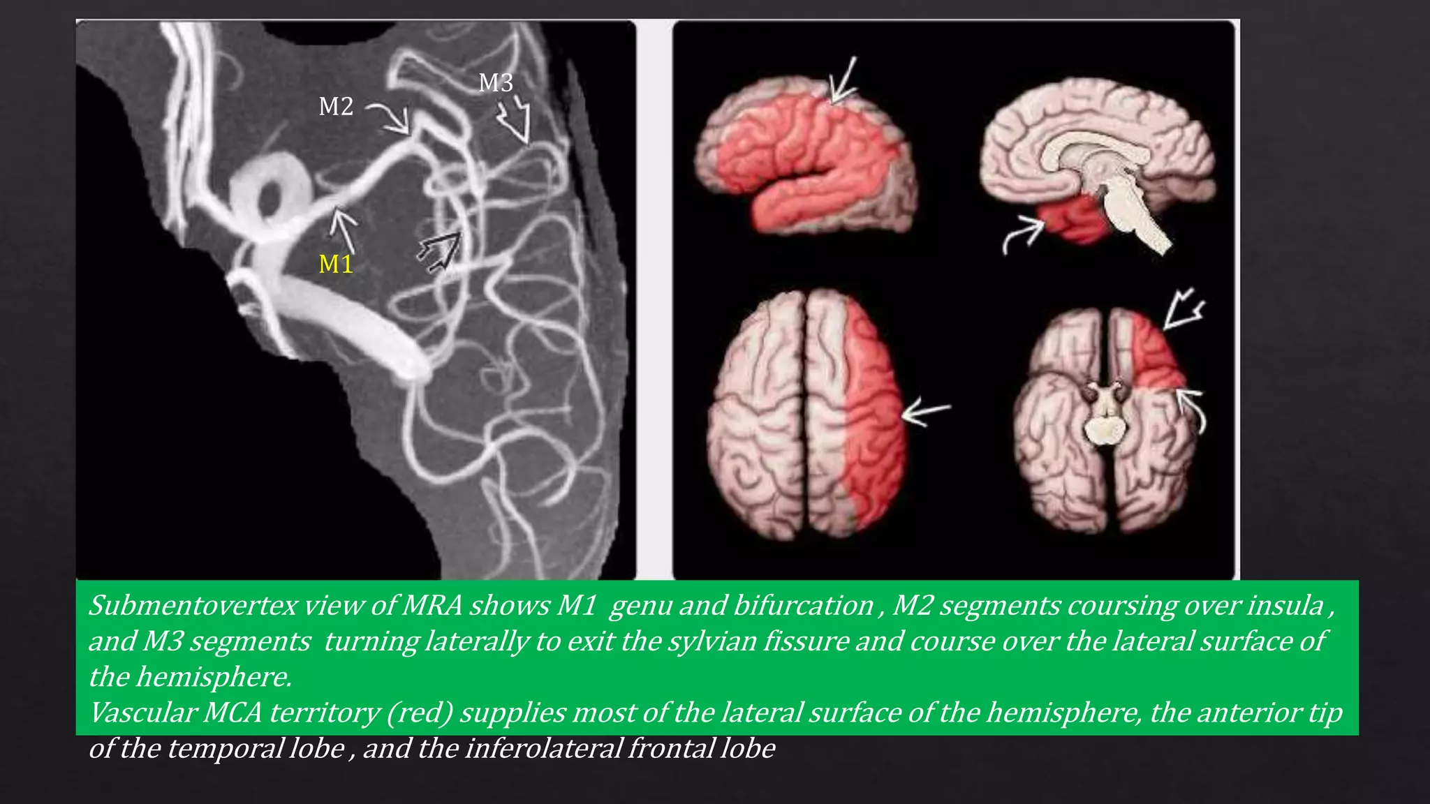 Vascular anatomy of brain | PPTX