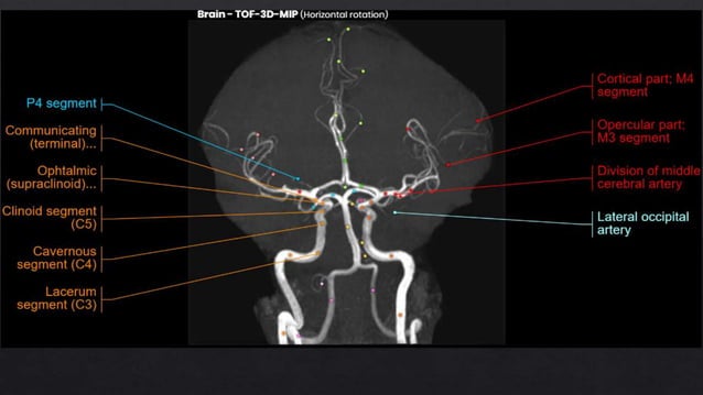 Vascular anatomy of brain | PPTX | Death, Injury, or Military Conflict ...