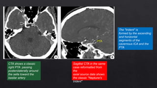Vascular anatomy of brain | PPTX