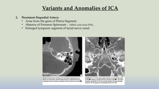 Vascular Anatomy of Brain............pptx