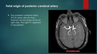 vascularanatomy of brain by dr budha ram.pptx
