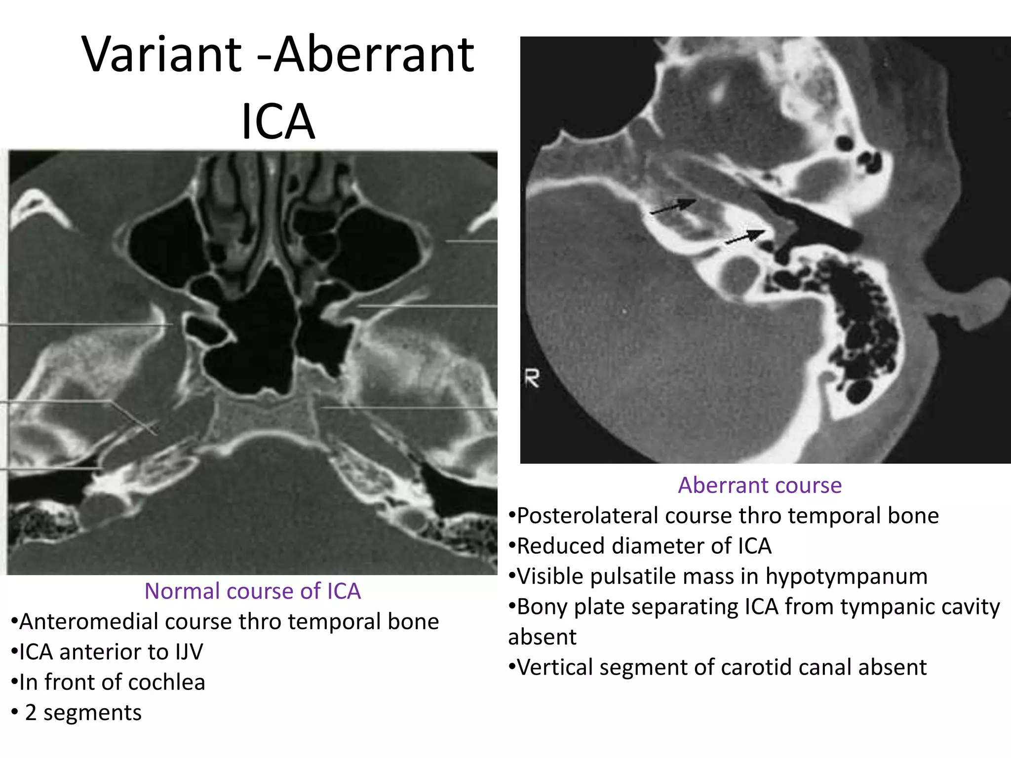 imaging and anatomy of blood supply of brain | PPTX