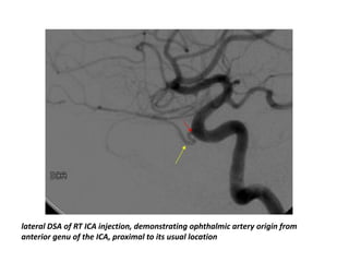 imaging and anatomy of blood supply of brain | PPTX