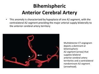 imaging and anatomy of blood supply of brain | PPTX