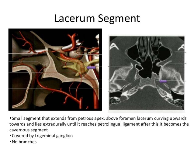 imaging and anatomy of blood supply of brain