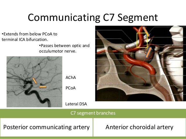 imaging and anatomy of blood supply of brain