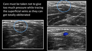 Vascular anatomy of extremities | PPT