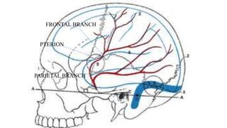 Vascular anatomy of head, [autosaved] | PPTX