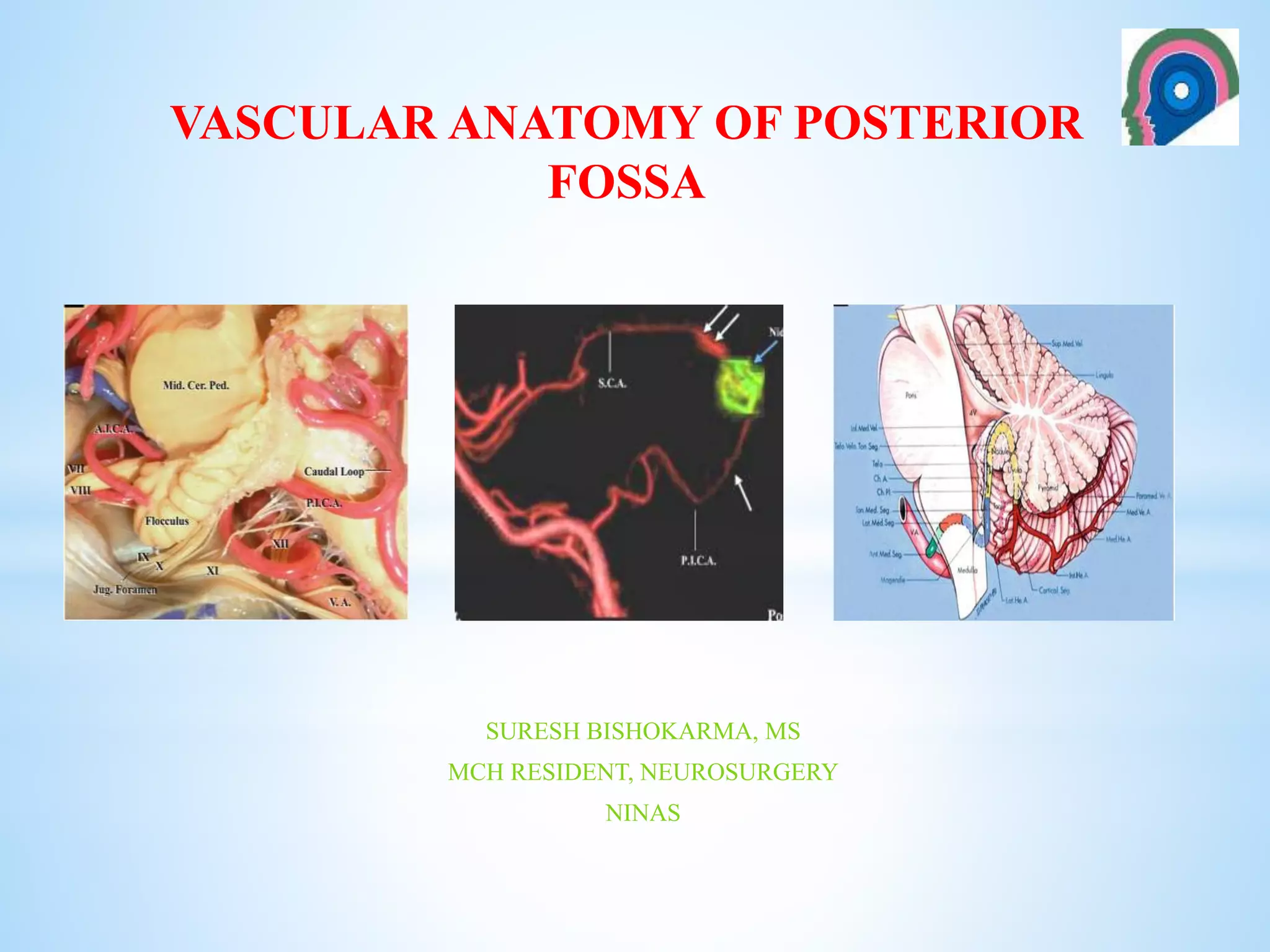 Vascular anatomy of posterior fossa | PPTX