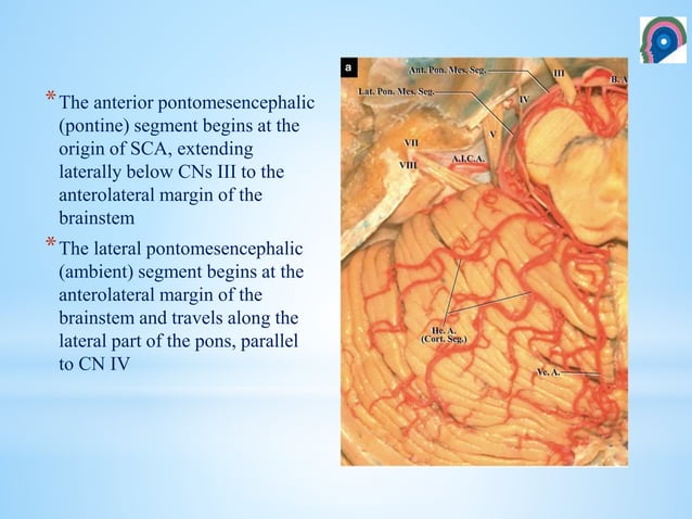 Vascular anatomy of posterior fossa | PPTX