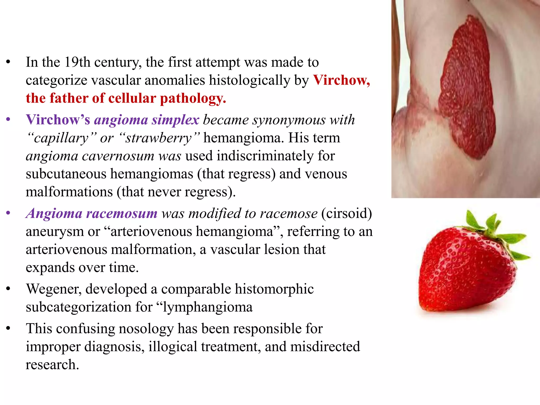 Vascular anomalies | PPTX