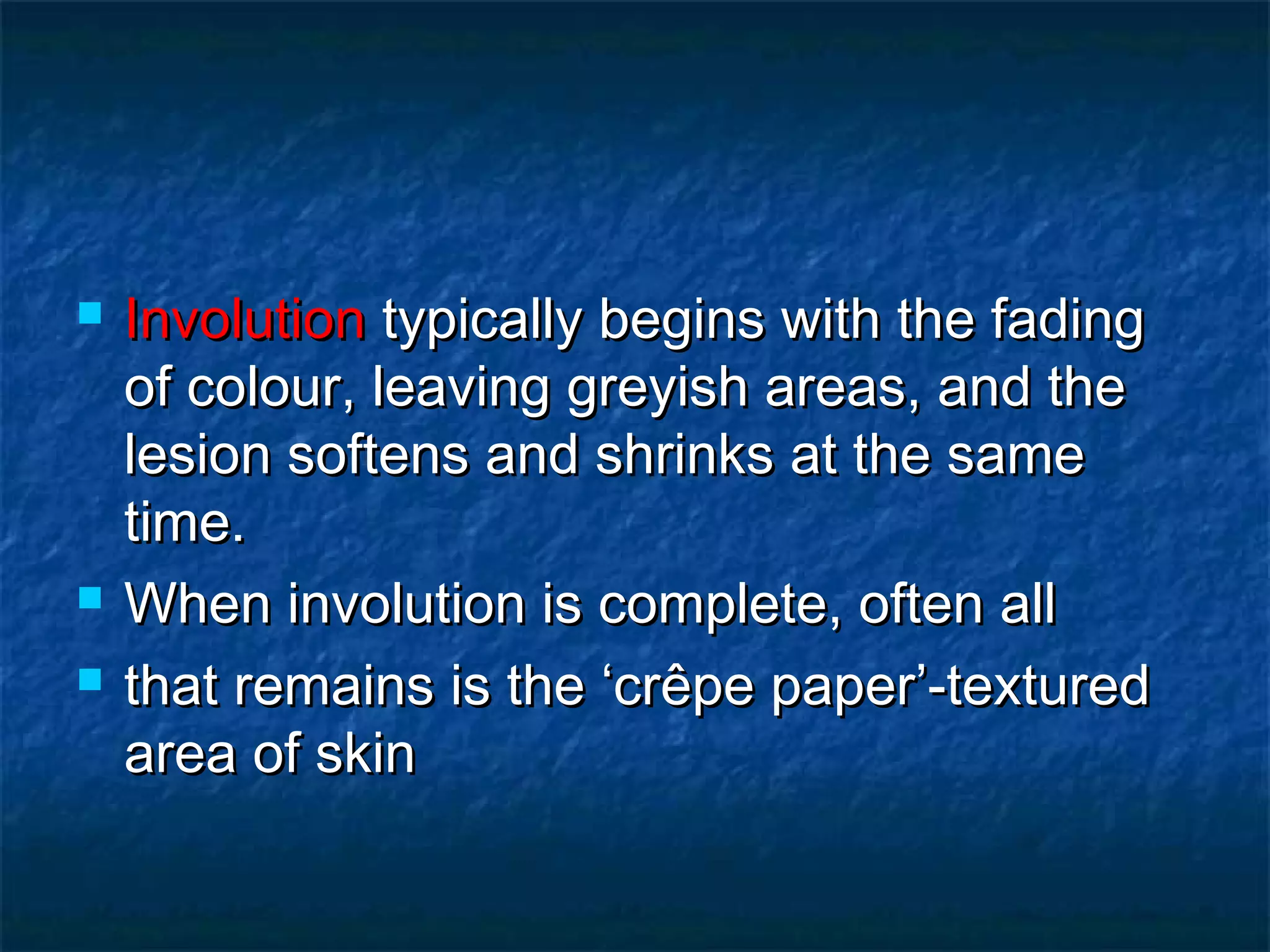 Hemangioma | PPT
